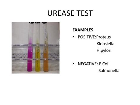 Salmonella Urease Test At Victor Vanhoy Blog