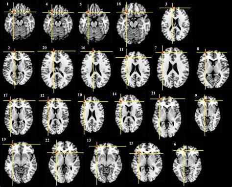 The Axial View Of Slices Of Decision Making Voxels And Crosshairs Are