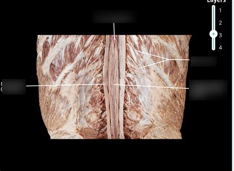 Bio 211 Lab Pal Human Cadaver Nervous System Slide 15 Diagram Quizlet