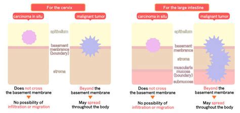 100 Basement Membrane Foto Stok Potret And Gambar Bebas Royalti Istock