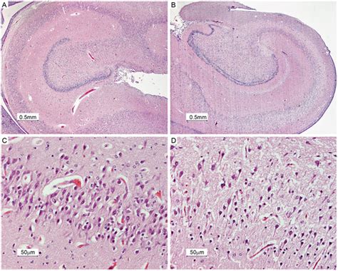 Hippocampus Histology
