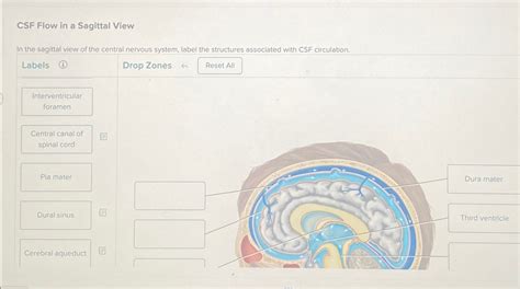 Solved Csf Flow In A Sagittal Viewin The Sagittal View Of