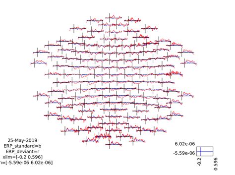 Preprocessing And Event Related Potentials In Eeg Data Fieldtrip Toolbox