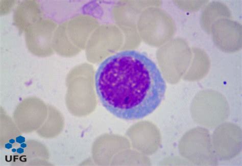 Hematología