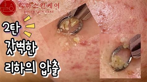 갓벽한 리하의 압출 2탄 Youtube