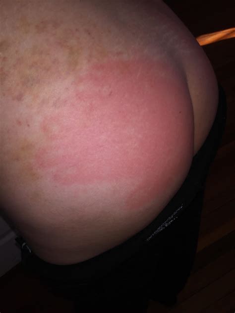 Glorious Handprint Rspanking