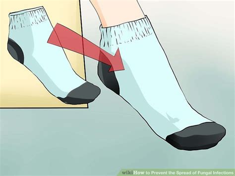 Хөлний мөөгөнцрийг хэрхэн эмчлэх вэ