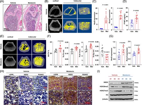 Melatonin Facilitates Osteogenesis Of Bone Marrow Stromal Cells Bmscs Download Scientific
