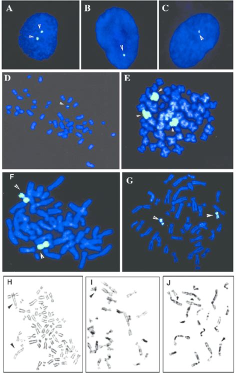 Fish On Metaphase Chromosomes And Interphase Nuclei A D D17z1