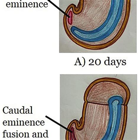 Secondary Neurulation Download Scientific Diagram