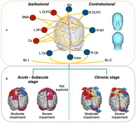 Frontiers Transcranial Direct Current Stimulation For Gait Recovery Following Stroke A