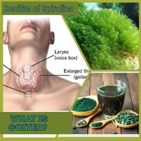 Spirulina What Is Goiter Goiter Is A Condition In Which The Thyroid Gland Grows Larger