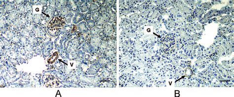 Representative Examples Of Ddr1 Expression Revealed By Download