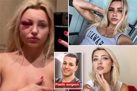 Plastic Surgeon Accused Of Transforming Model Into Sex Slave Through