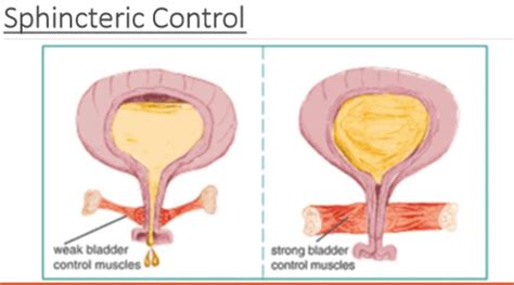 Pelvic Floor Dysfunction Flashcards Quizlet