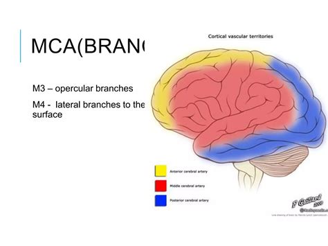 Brain Vascular Anatomy With Mra And Mri Correlation Ppt
