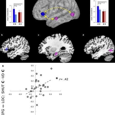 Role Of Left Vlpfc In Episodic Retrieval During Visual Distraction A Download Scientific