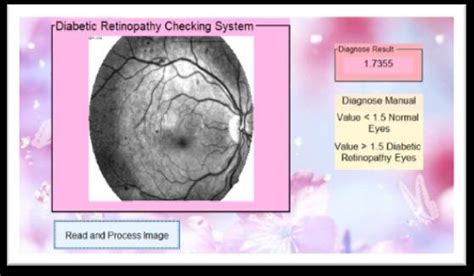 Complete Gui Design For Detection Of Diabetic Retinopathy Download Scientific Diagram