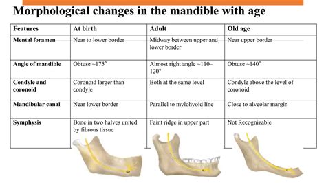 Mandibular Fracture In Plastic Surgerypptx Death Injury Or Military Conflict Sensitive Topics Mandibular Fracture In Plastic Surgerypptx Death Injury Or Military Conflict Sensitive Topics