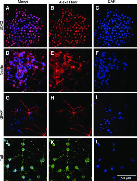 Expression Of Markers For Immature Neural Stem Cells And Mature