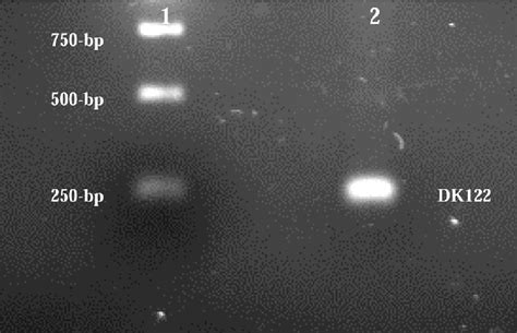 Pcr Of Sequence Characterized Amplified Region Scar Dk122 Lane 1 Download Scientific