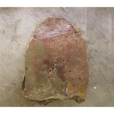 Basket Weave Pattern Of Paucicellular Collagen Fibres In Diffuse Download Scientific Diagram