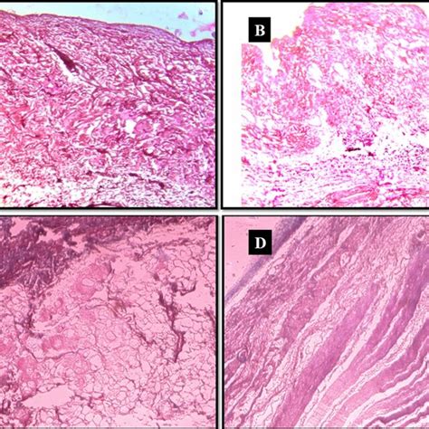 Conservation Of Ecm 3d Structure Of Acellular Scaffolds Sem Of The