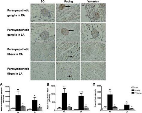 Atrial Parasympathetic Nerve Sprouting And Heterogeneous Download
