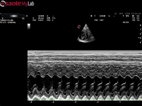 Vsd In A Cat Members