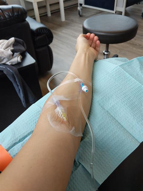 Entyvio 2nd Loading Dose Rulcerativecolitis