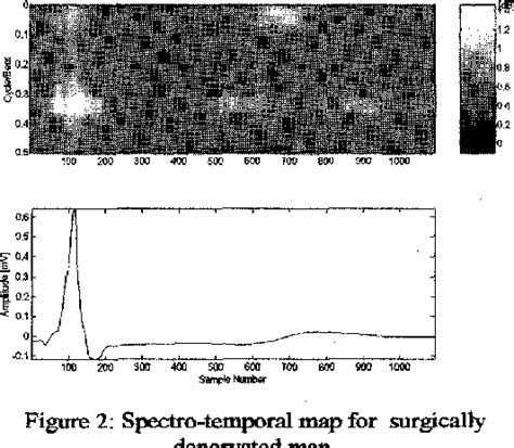 Figure 2 From A New Spectro Temporal Method For Ecg Morphology