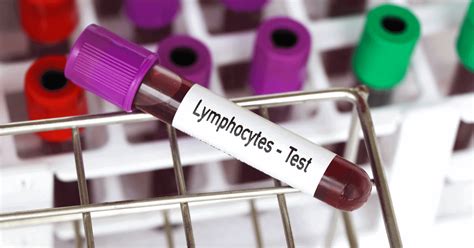 Lymphocytosis High Lymphocyte Count Symptoms Causes And Diagnosis