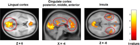 Brain Activation In Lingual Cortex Cingulate Cortex And Insula Download Scientific Diagram