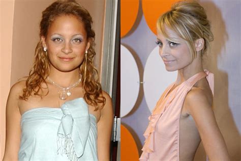 Nicole Richie Fat And Skinny