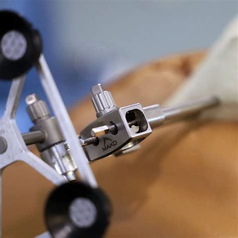 Advanced Surgical Technology For Total Joint Replacements