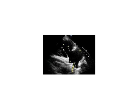 Rvit View Anatomy Echo — Printable Worksheet