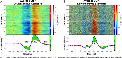 Figure 1 From Nonlinear Dynamics Underlying Sensory Processing Dysfunction In Schizophrenia