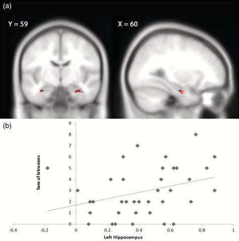 A Neural Correlates Displayed For The Sleep Groups Compared To Download Scientific Diagram