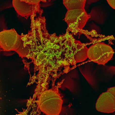 Enterococcus Faecalis Produces Abundant Extracellular Structures Containing Dna In The Absence