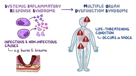 Multiple Organ Dysfunction Syndrome Mods Video And Meaning Osmosis