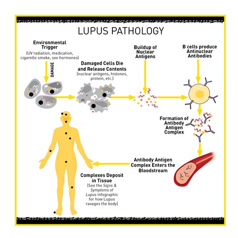 Lupus Fighting An Invisible Monster Hudsonalpha Institute For Biotechnology