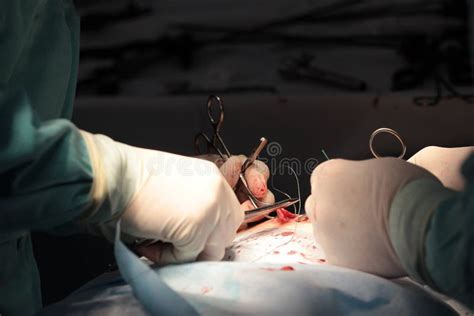 Completion Of The Operation To Remove The Inguinal Hernia The Surgeon