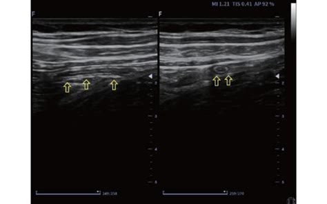 Finus 50 Pt Aktif Saintifik Indonesia