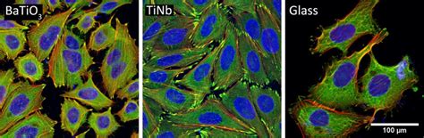 Immunofluorescence Staining Of Vinculin Green F Actin Cytoskeleton