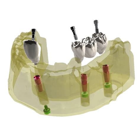 Adin Rs Digital Model Analog Rs1000