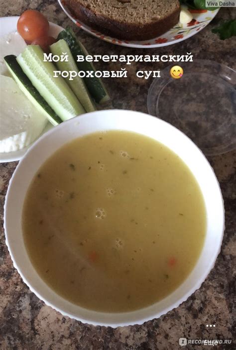 Брекет системы брекеты ортодонтические скобы «👄sex позиция резцов что это Как изменился