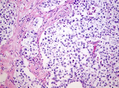 Testicular Histology Pathology Outlines