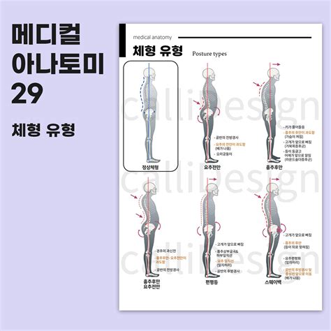 의학그림 메디컬 일러스트 Callidesign 나쁜체형 좋은체형 비교 포스터 디자인입니다 참고용 교육용으로 사용하실 수 있게 A4파일로 제공되는 디자인입니다