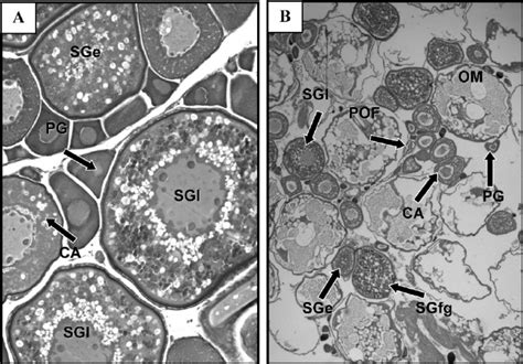 Histological Sections Of Silver Perch Ovaries A Spawning Capable Download Scientific Diagram
