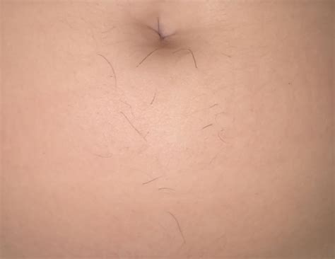 Information And Content For Those With Or Curious About Hirsutism